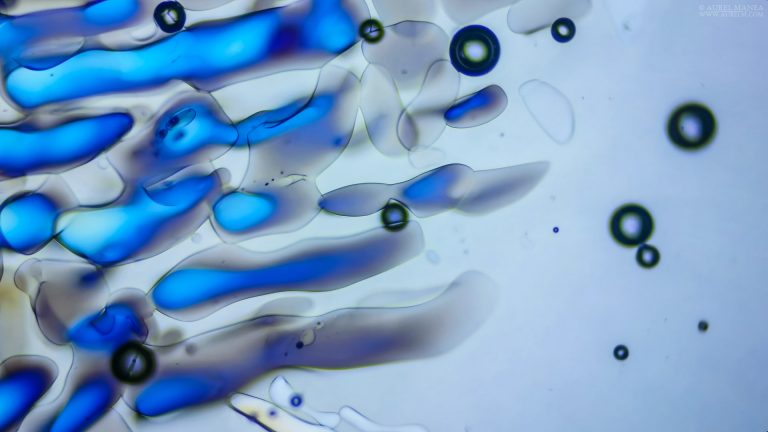 Gallery Ice crystals under polarized light microscope 15 - Dystalgia ...